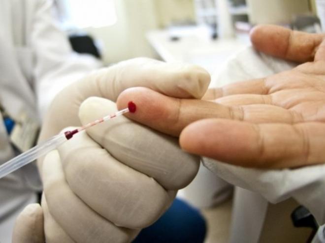 Unidades De Saúde Oferecem Testes Rápidos Para Detecção De Ists
